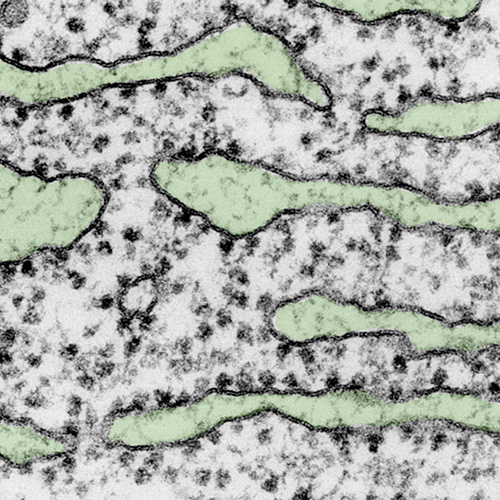 Discovery of a factor that accelerates protein deliveries to the ...