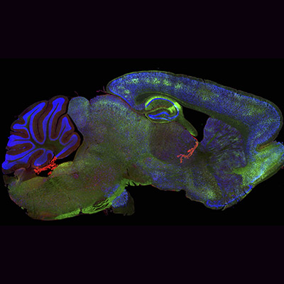 New potential therapy for neurodegeneration removes tau aggregates and ...