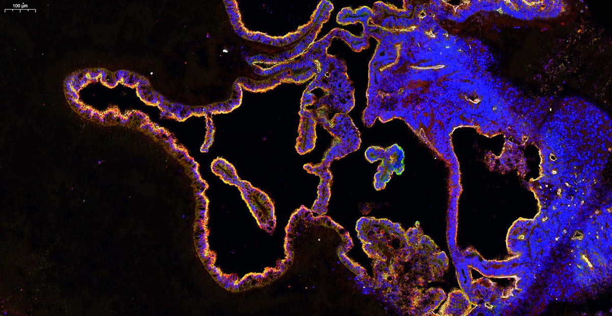 Brain organoids with the potential to predict drug permeability - MRC ...