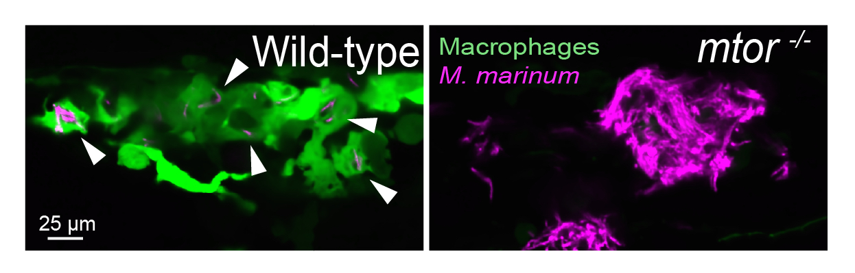 Identification of pathway that enables resistance to tuberculosis - MRC ...