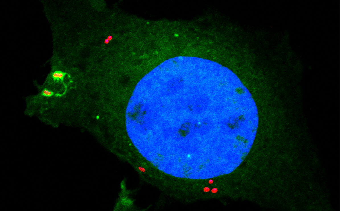 New pathway for cells to detect bacterial infection - MRC Laboratory of ...