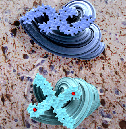 Telling the tale of tangled tau in Alzheimer’s disease - MRC Laboratory ...